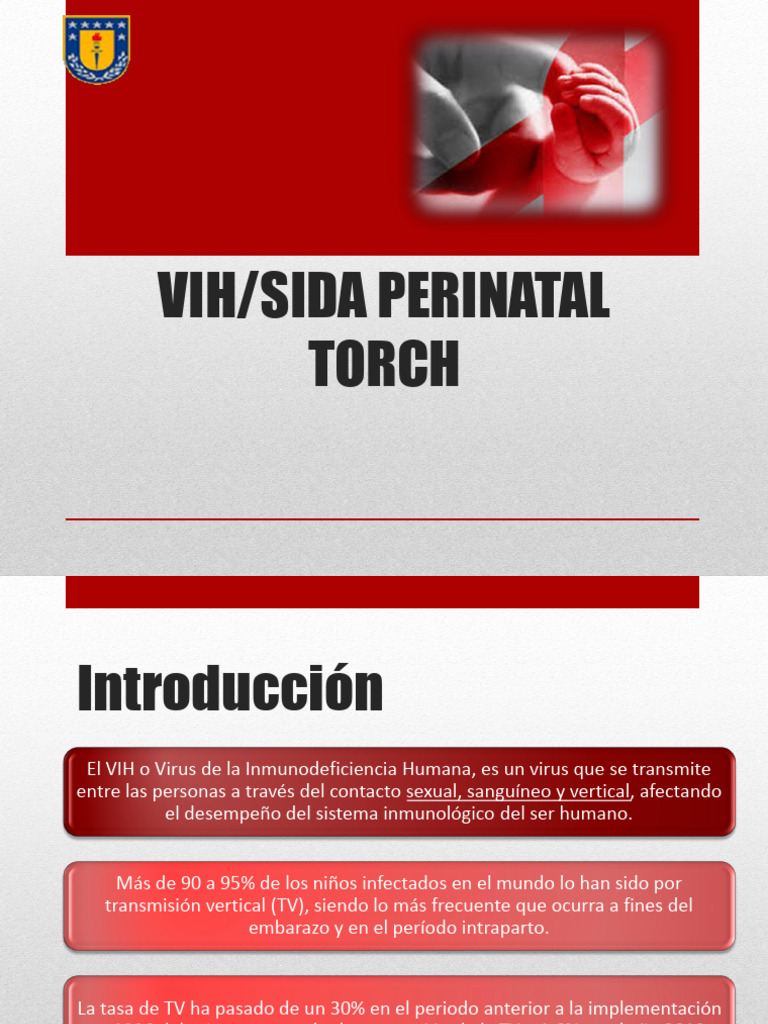VIH/SIDA Perinatal y TORCH | PDF | VIH | Parto