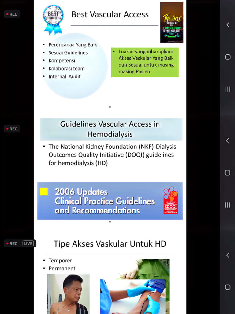 Akses Vaskular Terbaik Untuk HD | PDF