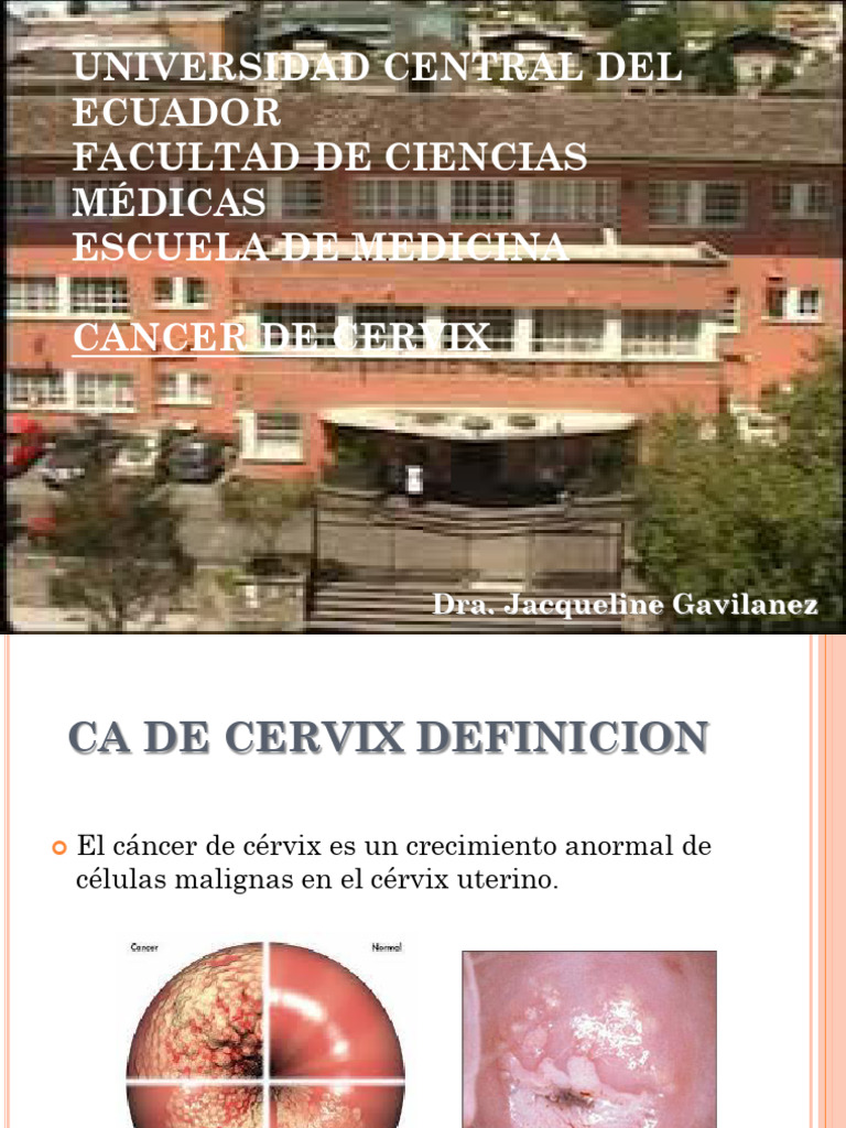 Cáncer de Cérvix: Epidemiología y Tratamiento | PDF | Cáncer de cuello ...