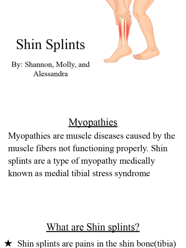Shin Splints | PDF
