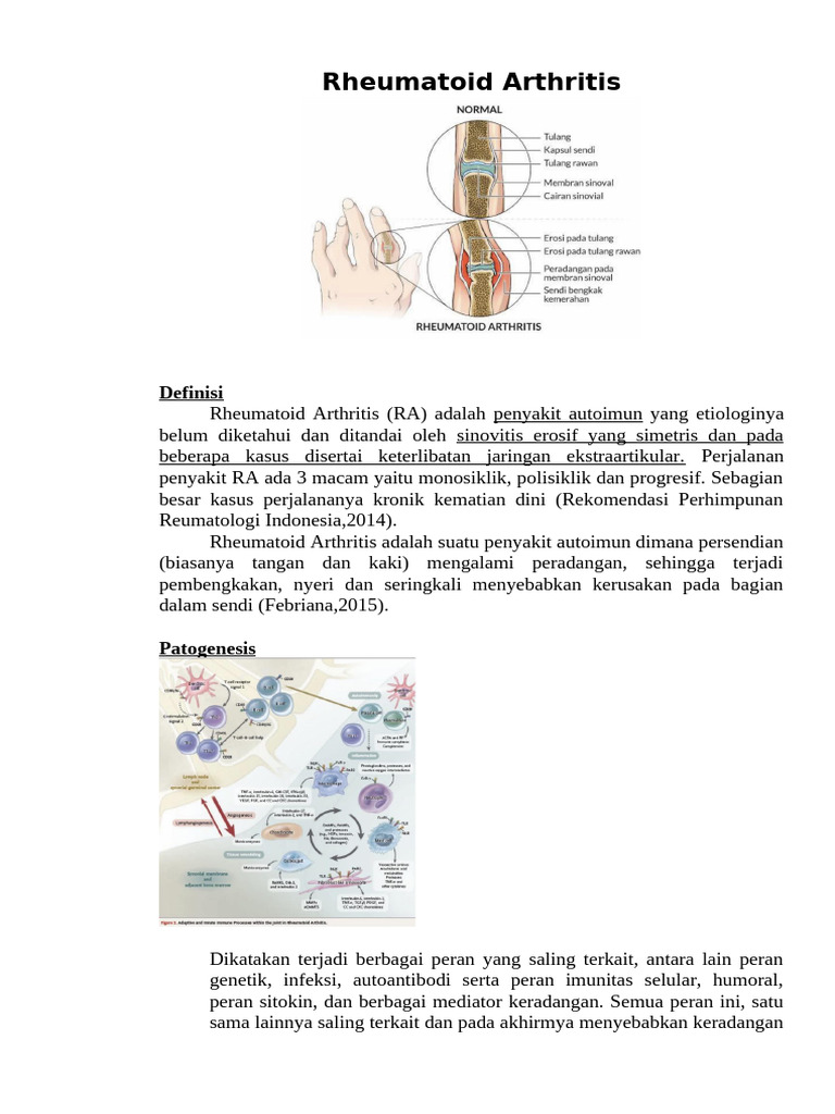 rheumatoid arthritis | PDF