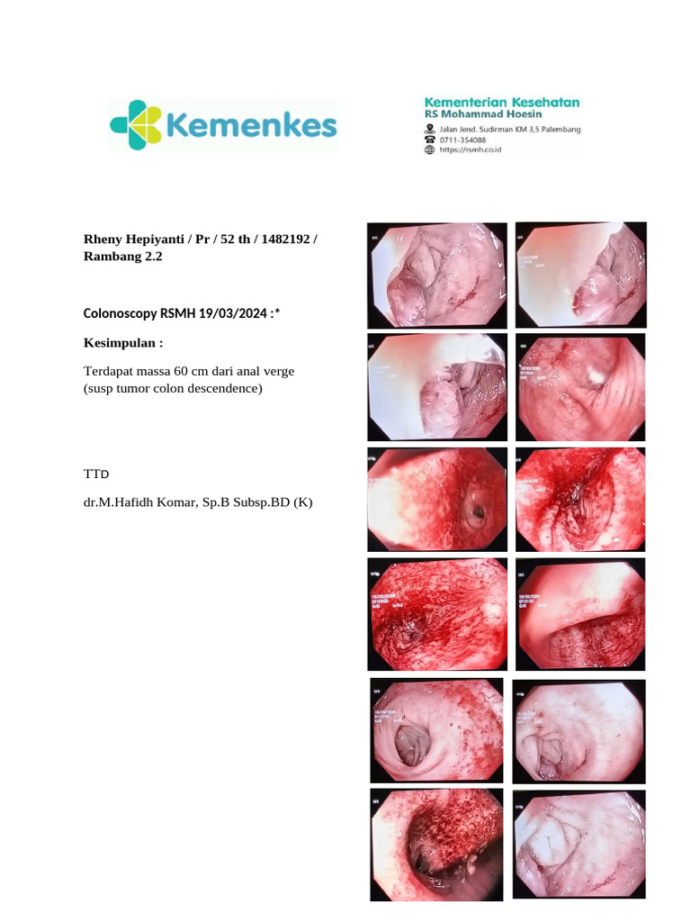 colonoscopy rheny | PDF