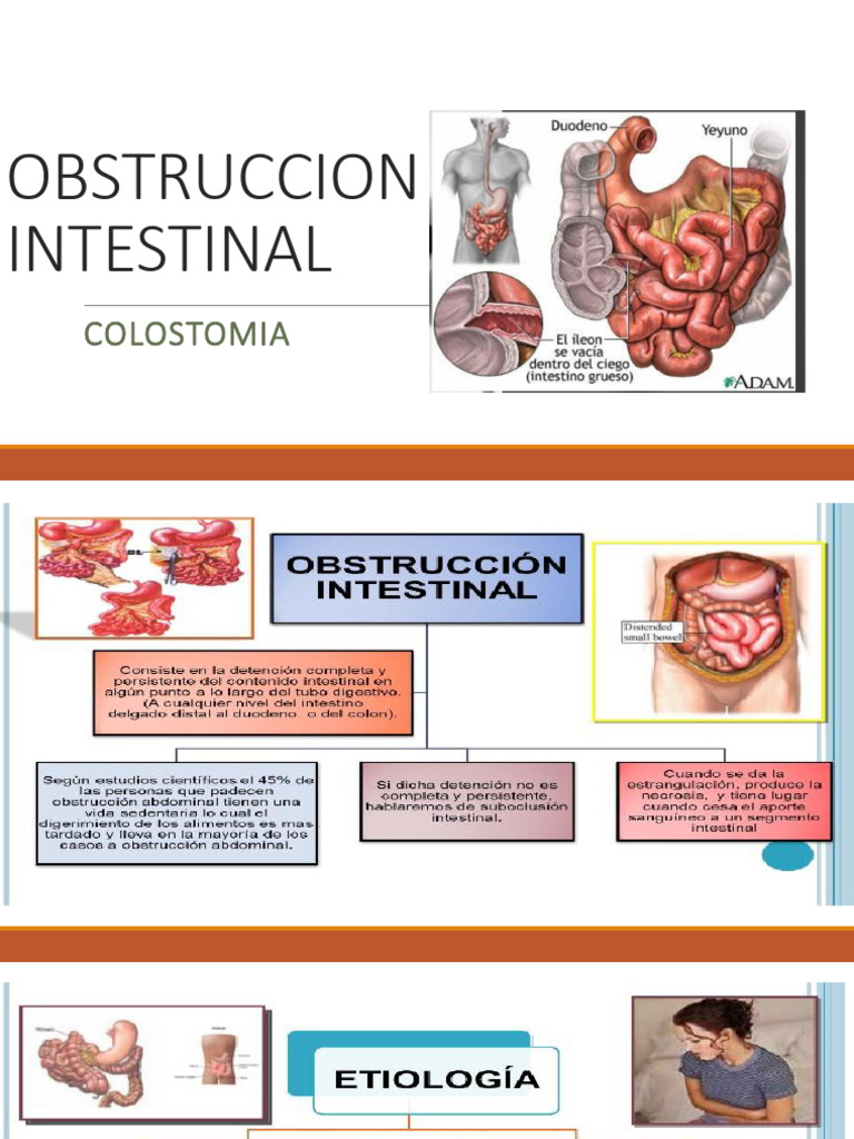 Obstruccion Intestinal | PDF