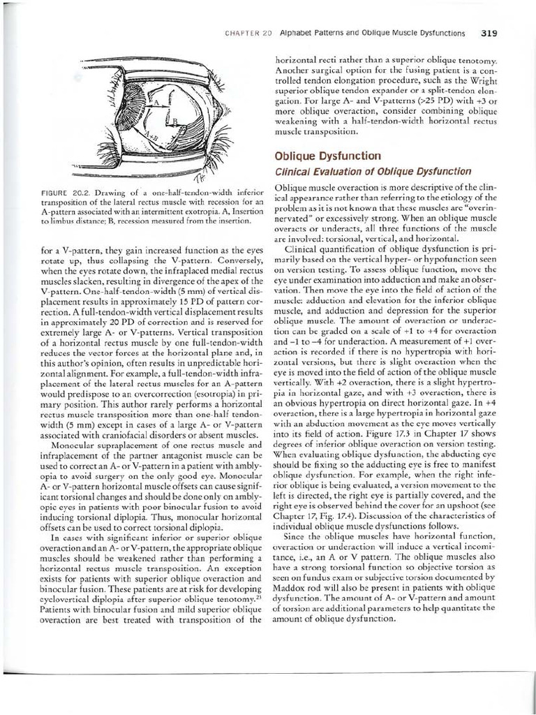 Pediatric Ophthalmology and Sts （Kenneth W. Wright 3rd 2012） 319-350 | PDF