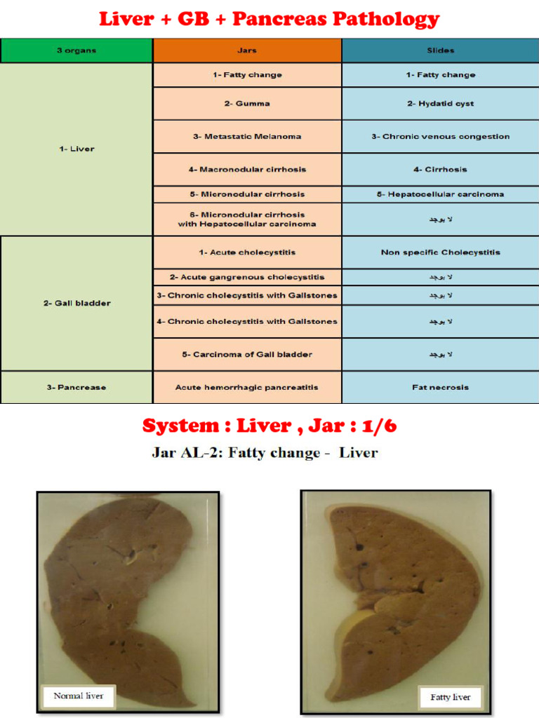 4 - Pathology Lab of Liver + GB + Pancrease | PDF