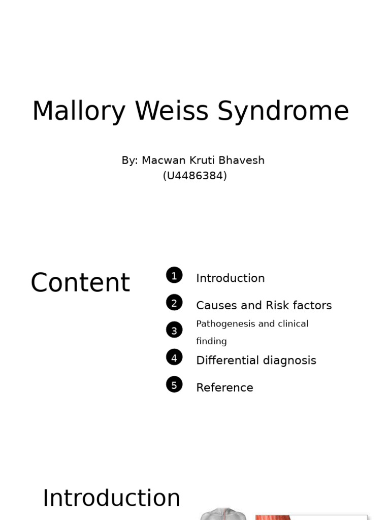 Mallory Weiss Syndrome | PDF