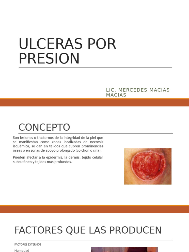 Causas y Clasificación de Úlceras por Presión | PDF