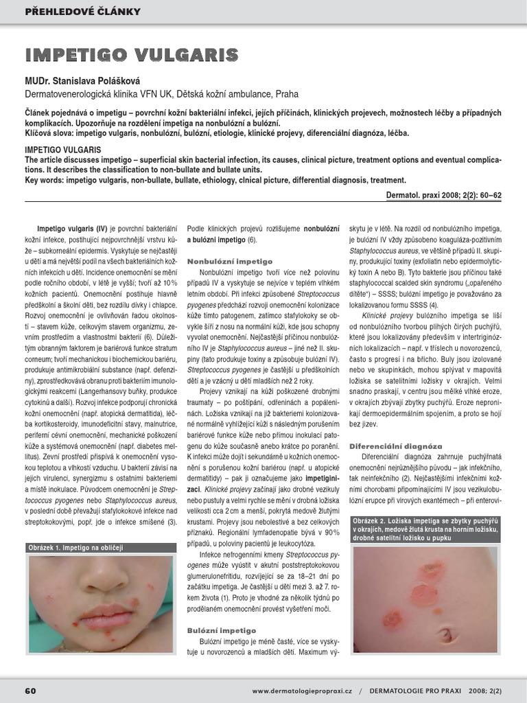 Impetigo Vulgaris | PDF