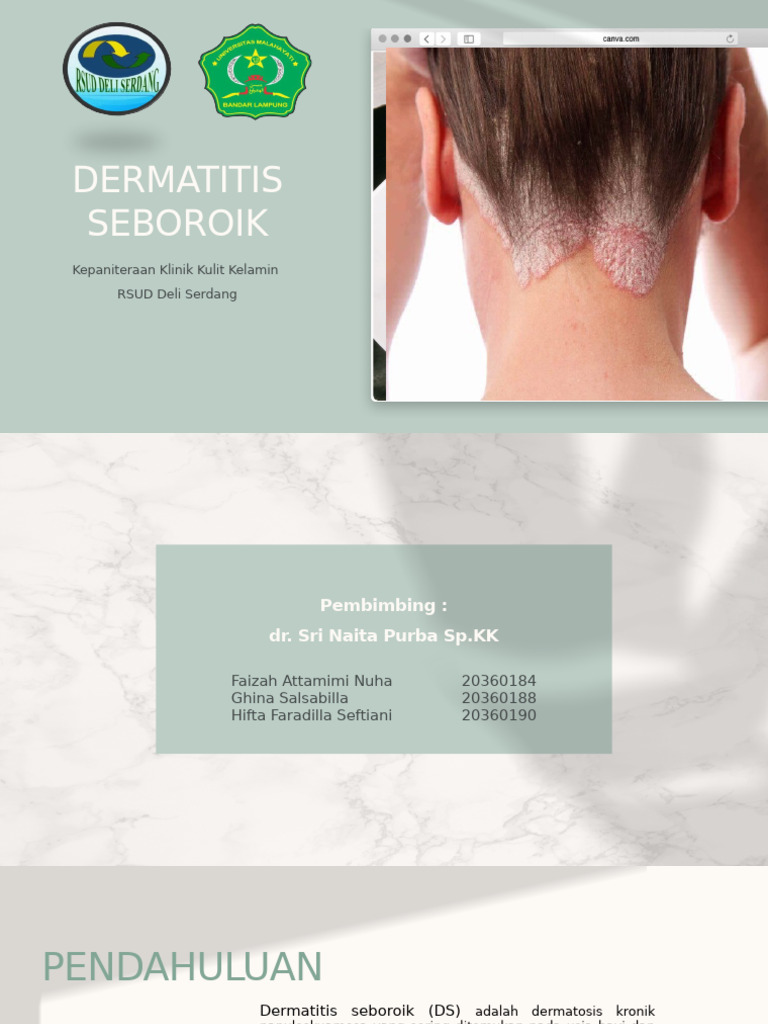 Refarat Dermatitis Seboroik Ppt | PDF