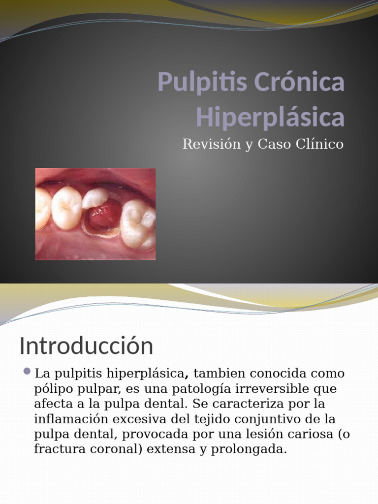 Caso Clinico Pulpitis Crónica Hiperplásica | PDF | Odontología | Especialidades Medicas