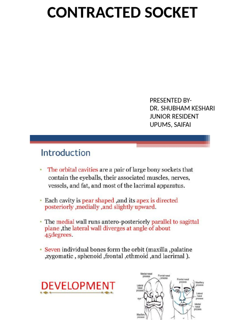 Contracted Socket | PDF