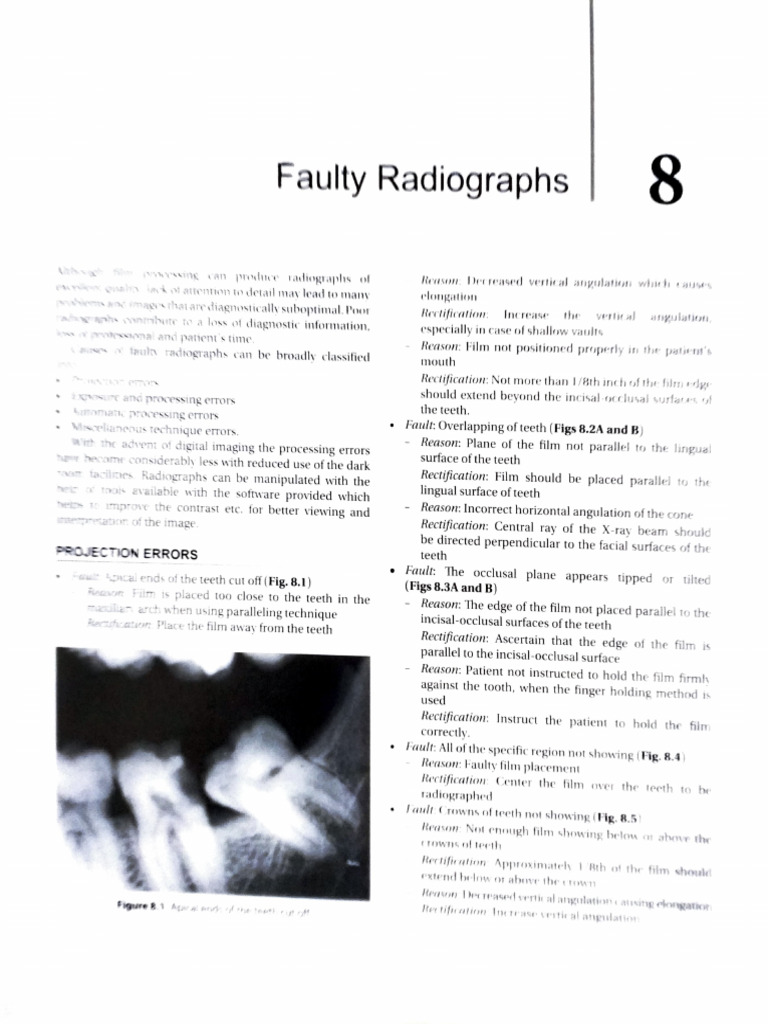 Faulty radiographs | PDF