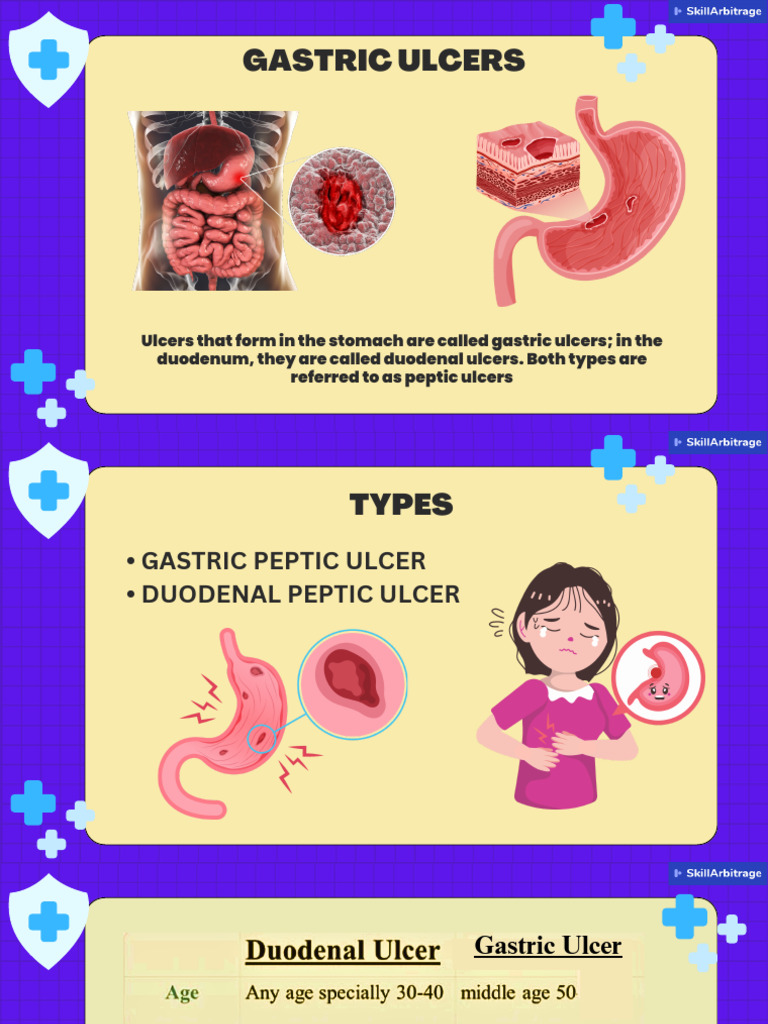 Ulcers | PDF