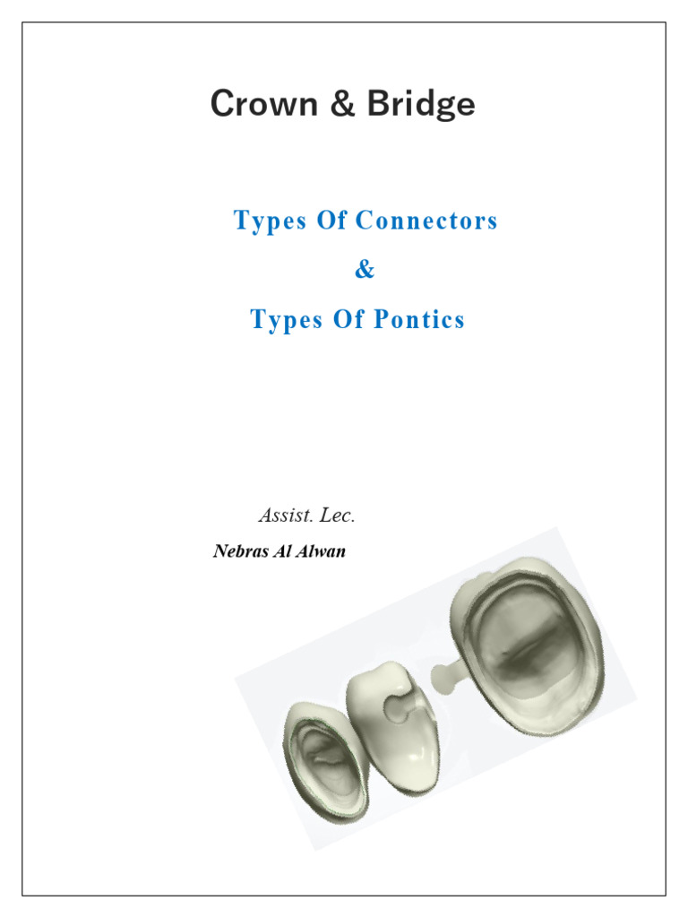 2 Types of Connectors& Pontics | PDF | Dentistry Branches