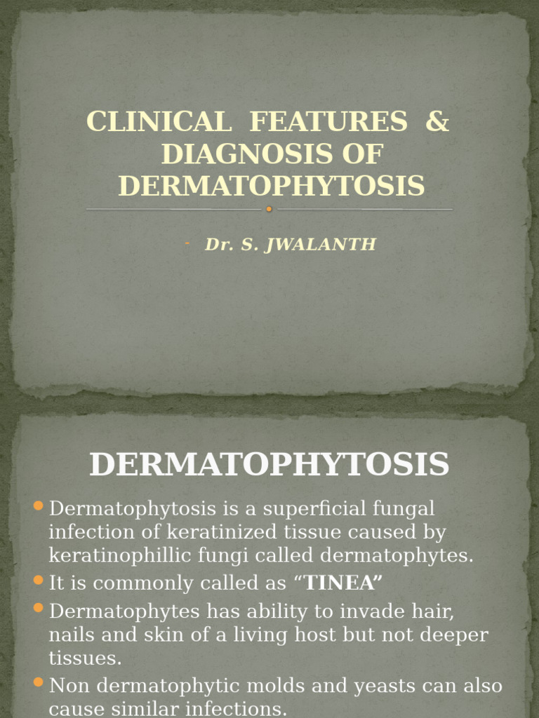 Clinical Features & Diagnosis of Dermatophytosis | PDF | Diseases And ...