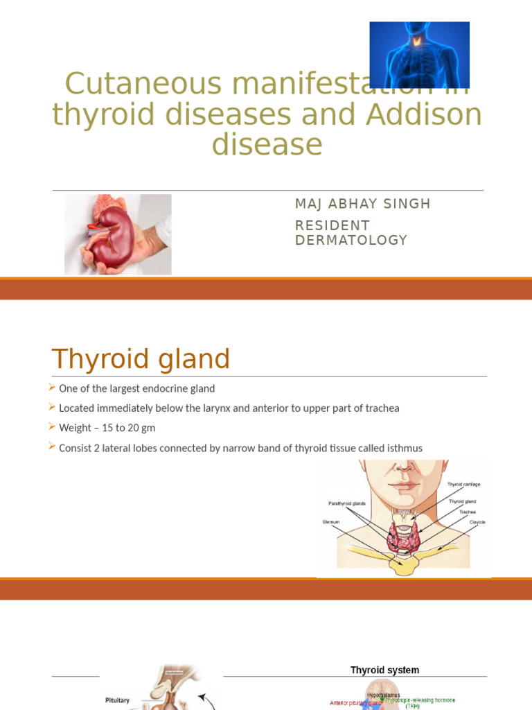 Cutaneous Manifestation of Thyroid Disease and Addison Disease | PDF | Thyroid | Hyperthyroidism