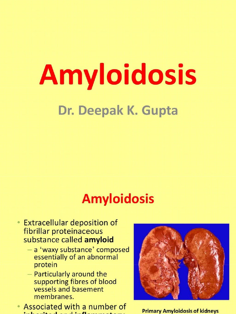 Amyloidosis 53513487 | PDF