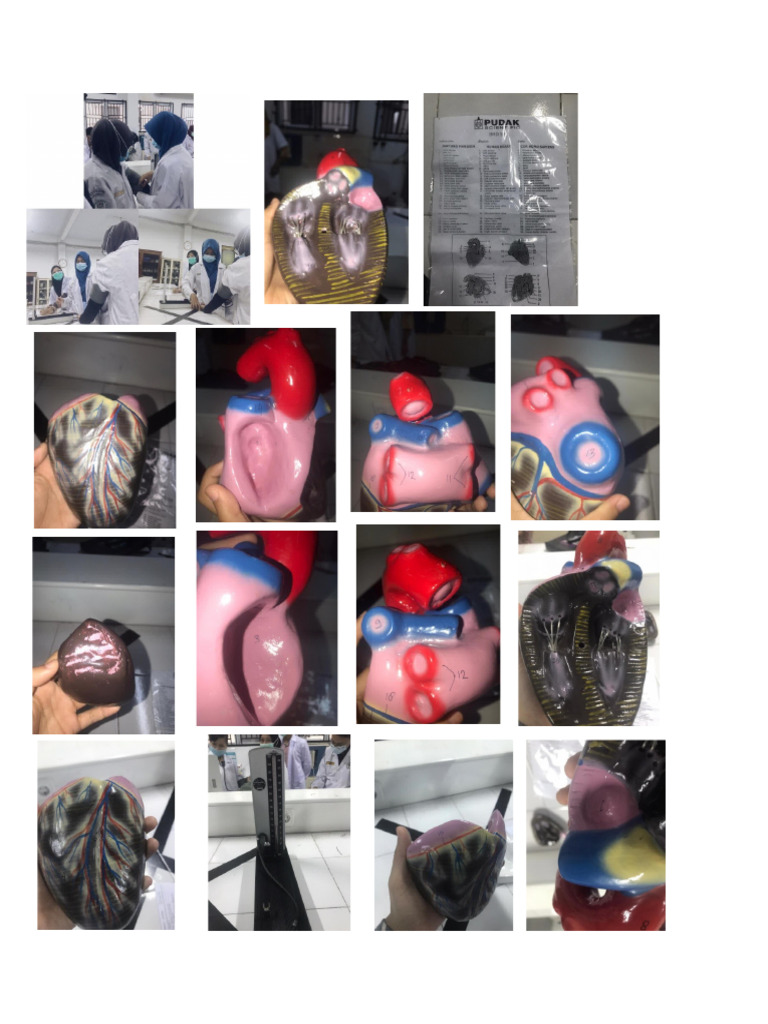 Anfiss | PDF