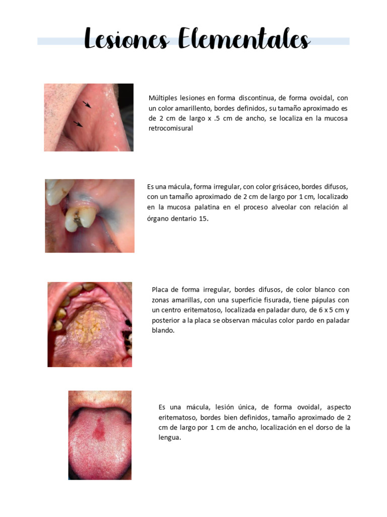Lesiones Elementales | PDF