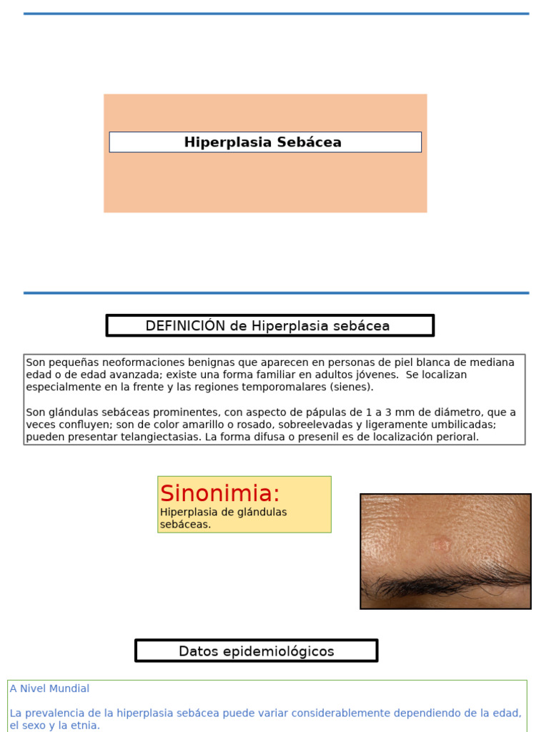 Hiperplasia Sebácea | PDF | Medicina CLINICA | Especialidades Medicas