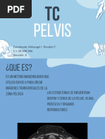 Anomalías de Transición Lumbosacra Por Tc. Método Castellvi | PDF | Vértebra | Sistema ...