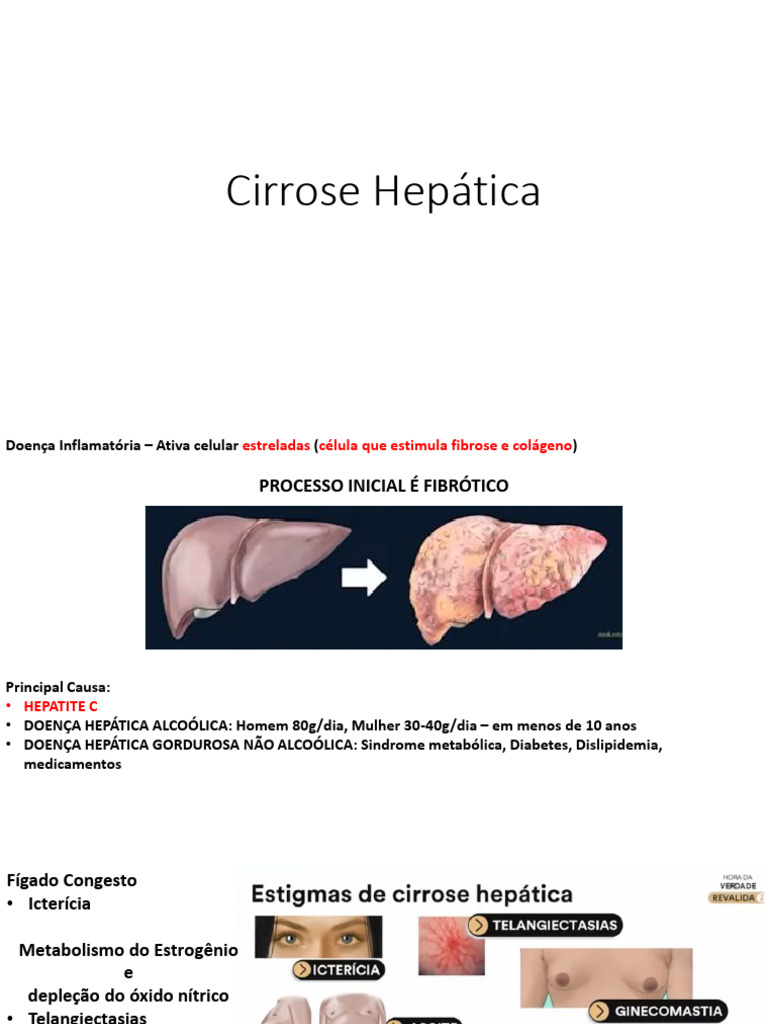 Cirrose Hepatica | PDF | Cirrose | Gastroenterologia
