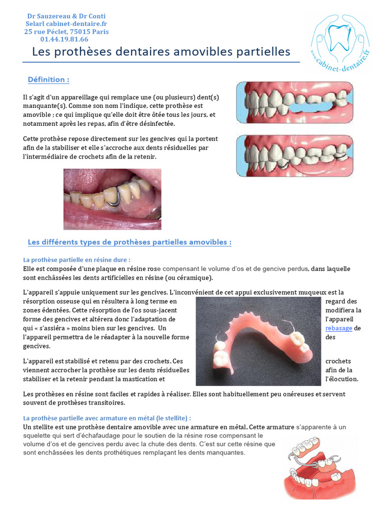 La Prothese Adjointe Partielle | PDF | Branches de la dentisterie
