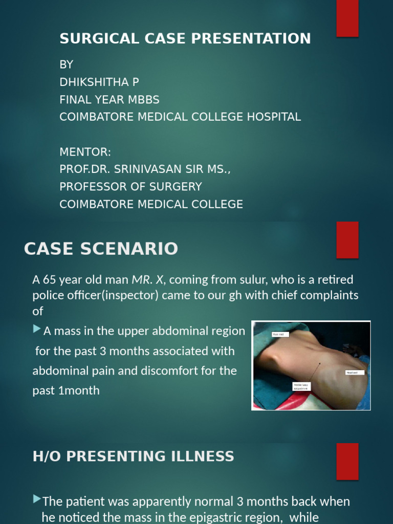 Epigastric Mass - Surgical Case Presentation | PDF | Abdomen | Medical ...