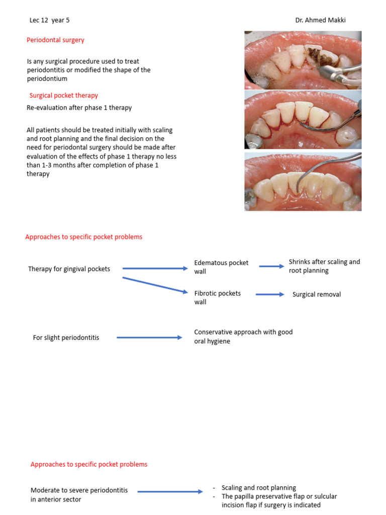 Perio 12 (1) | PDF | Periodontology | Surgery