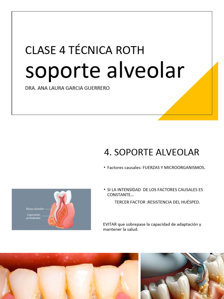 CLASE 4 DE LA TECNICA DE ROTH Soporte Alveolar | PDF | Odontología