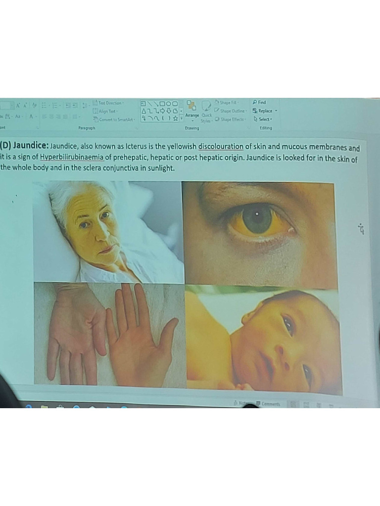 Spotting Genral Examinatioan Physio | PDF