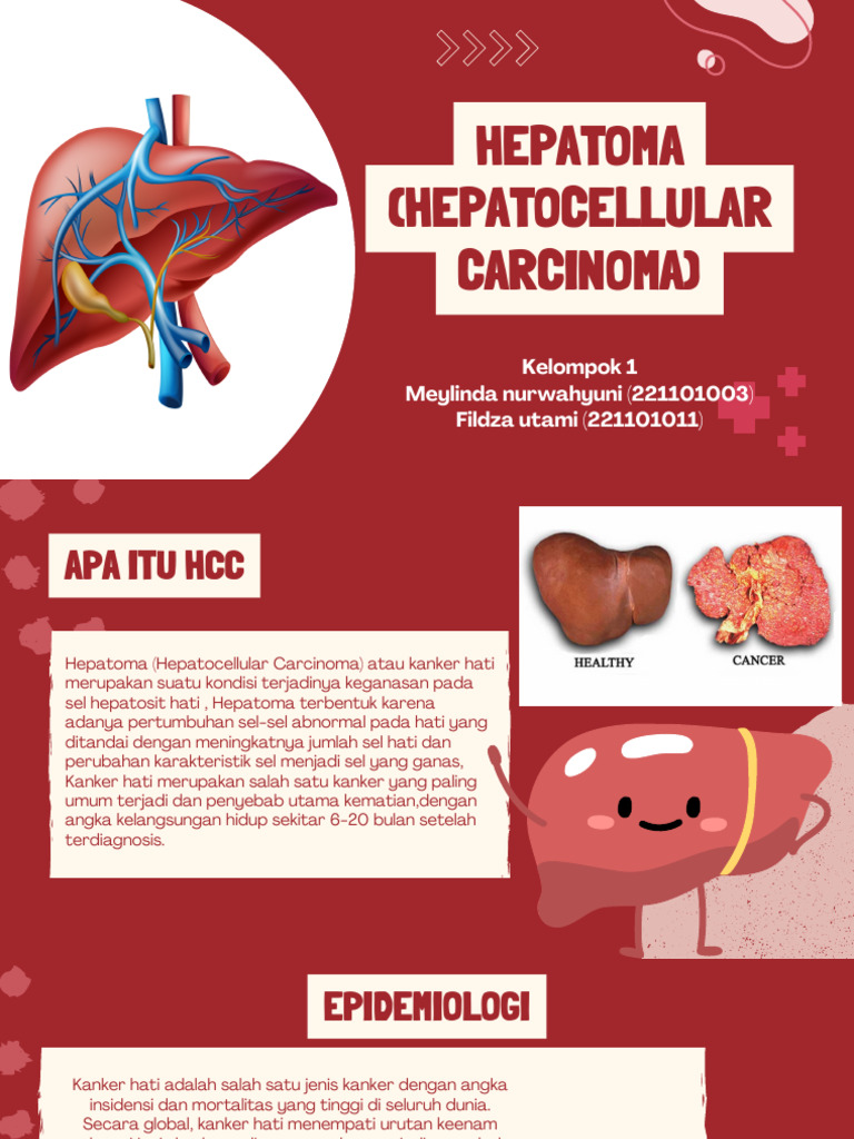 Panduan Lengkap tentang Hepatoma HCC | PDF
