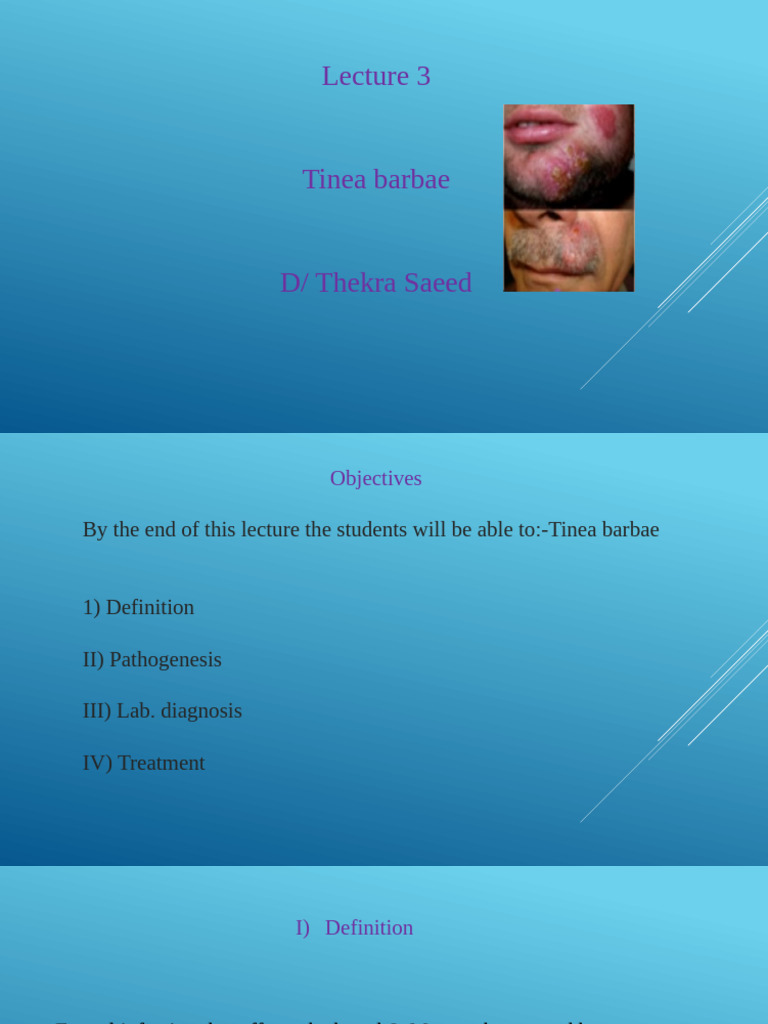 Tinea Barbae | PDF