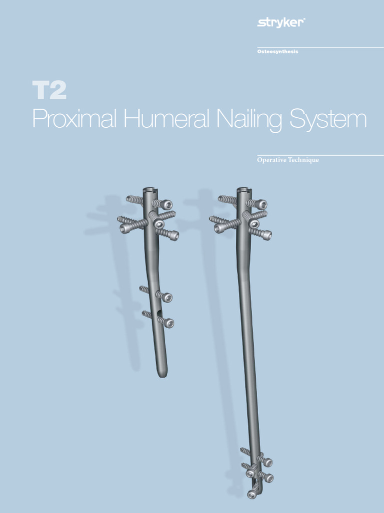 T2 Proximal Humeral Nailing System - Stryker | PDF | Screw | Orthopedic Surgery