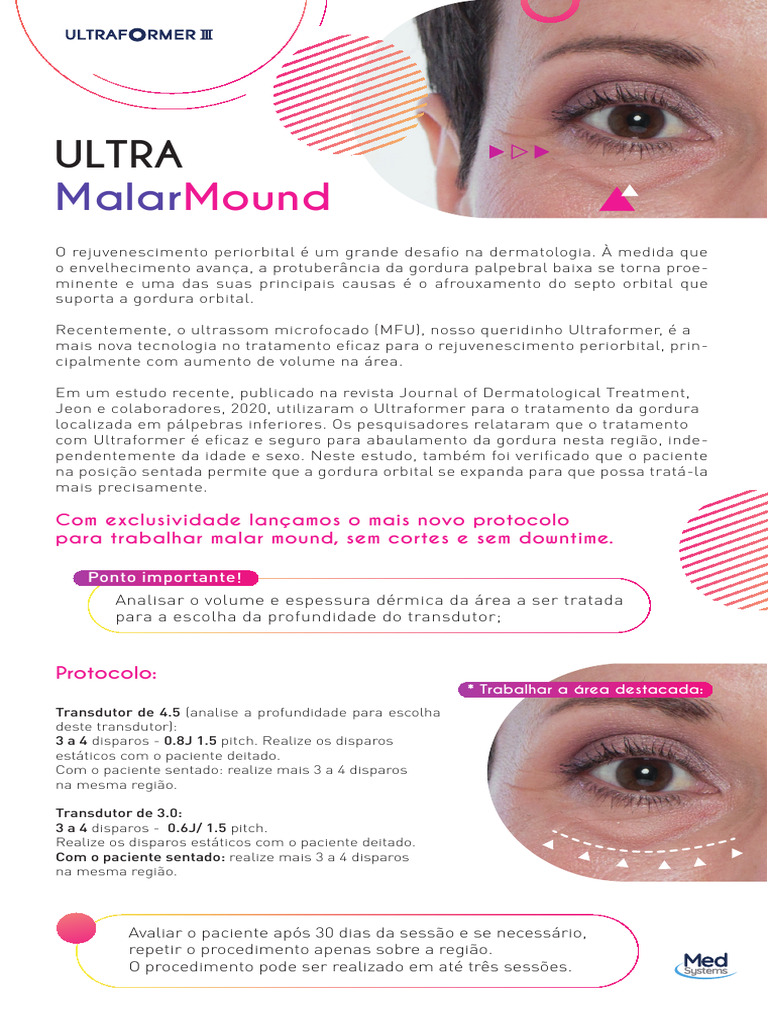 Protocolo Malar Mound | PDF
