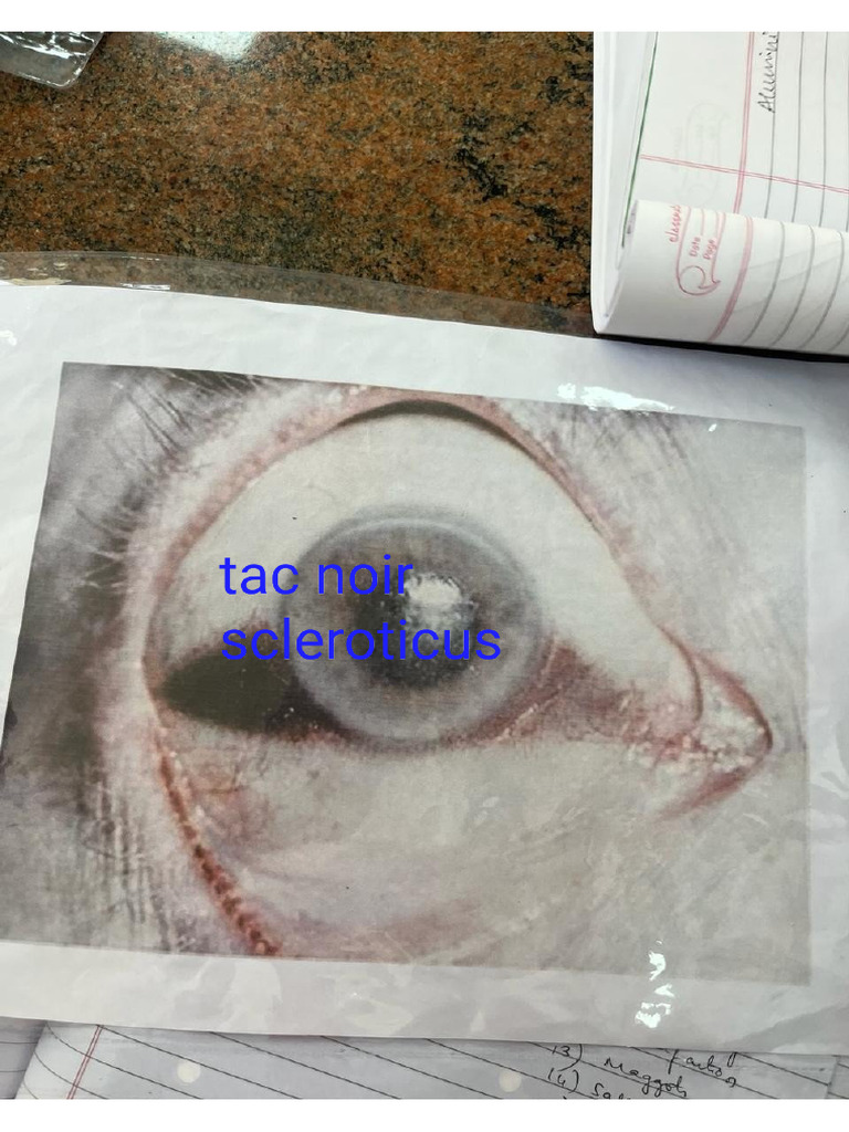 Forensic Charts | PDF