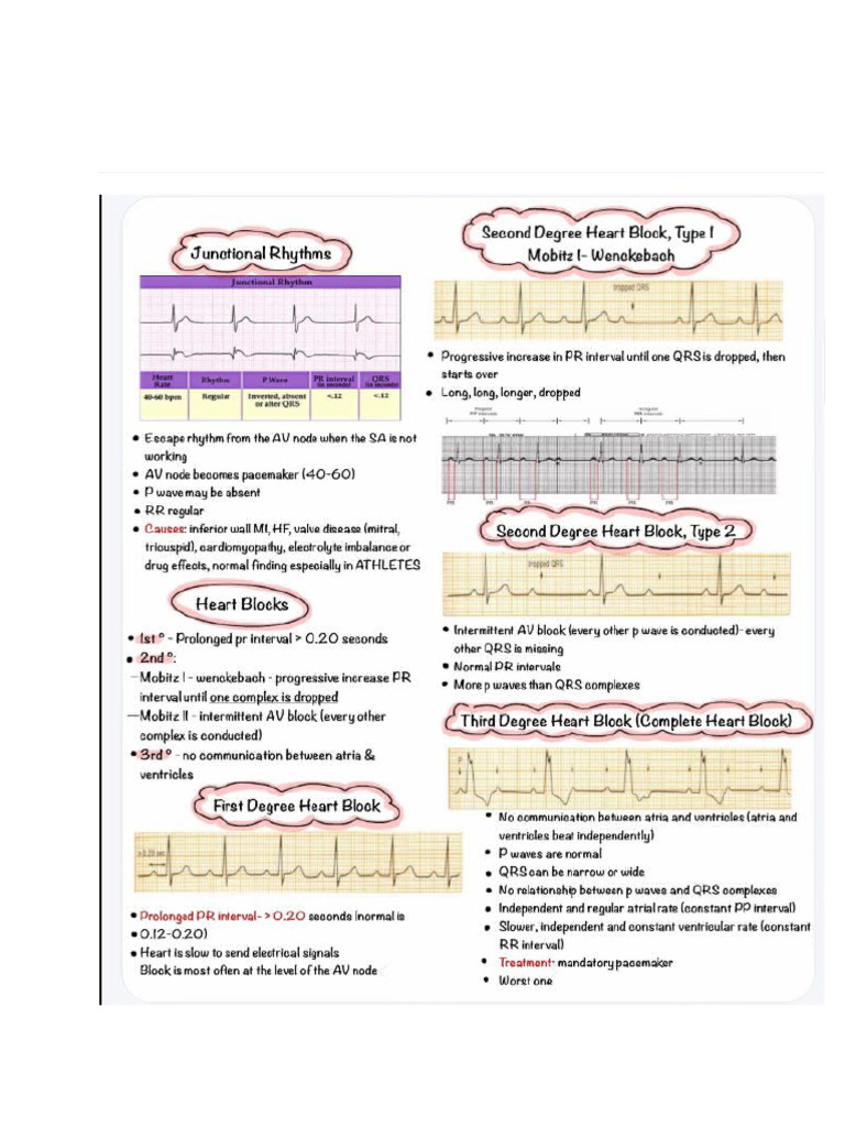EKG Rythms Part 3 | PDF