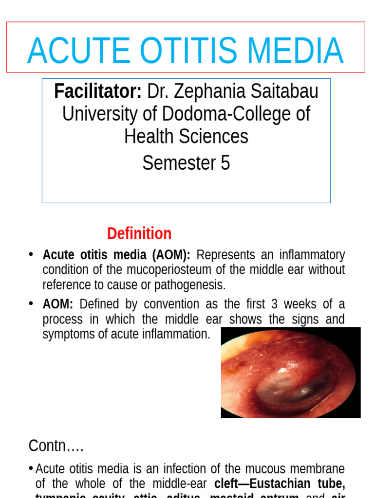 Stages of Acute Otitis Media Explained | PDF | Clinical Medicine ...