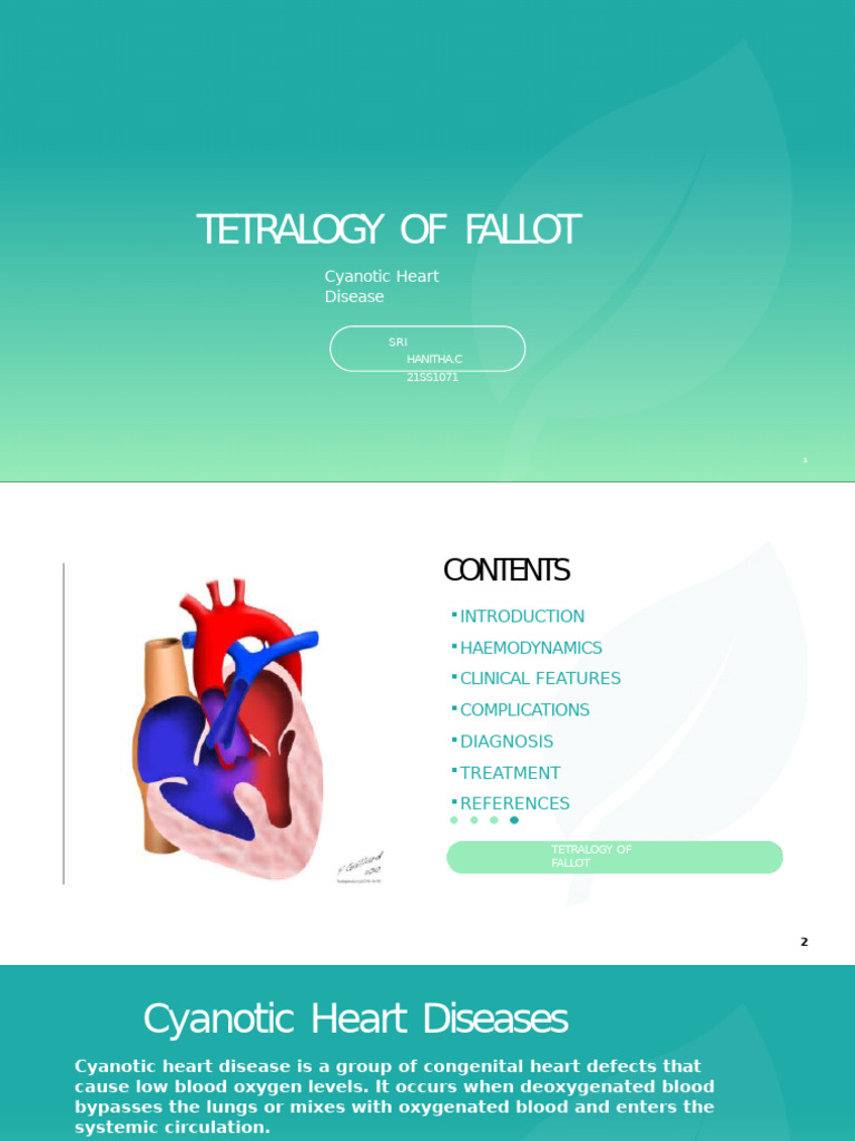 TETRALOGY OF FALLOT (2) | PDF | Congenital Heart Defect | Heart