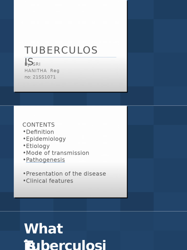 Tuberculosis | PDF | Tuberculosis | Health Sciences
