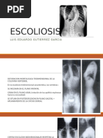 Signo de Risser | PDF | Escoliosis | Rtt