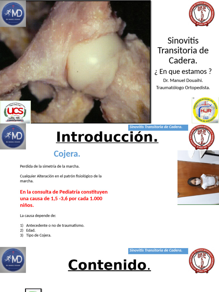 Sinovitis Transitoria en Niños | PDF | Artritis | Diagnostico medico