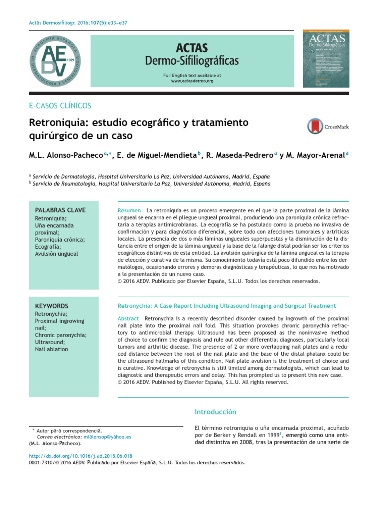 Retroniquia Estudio Ecográfico y Tratamiento | PDF | Clavo (anatomía ...