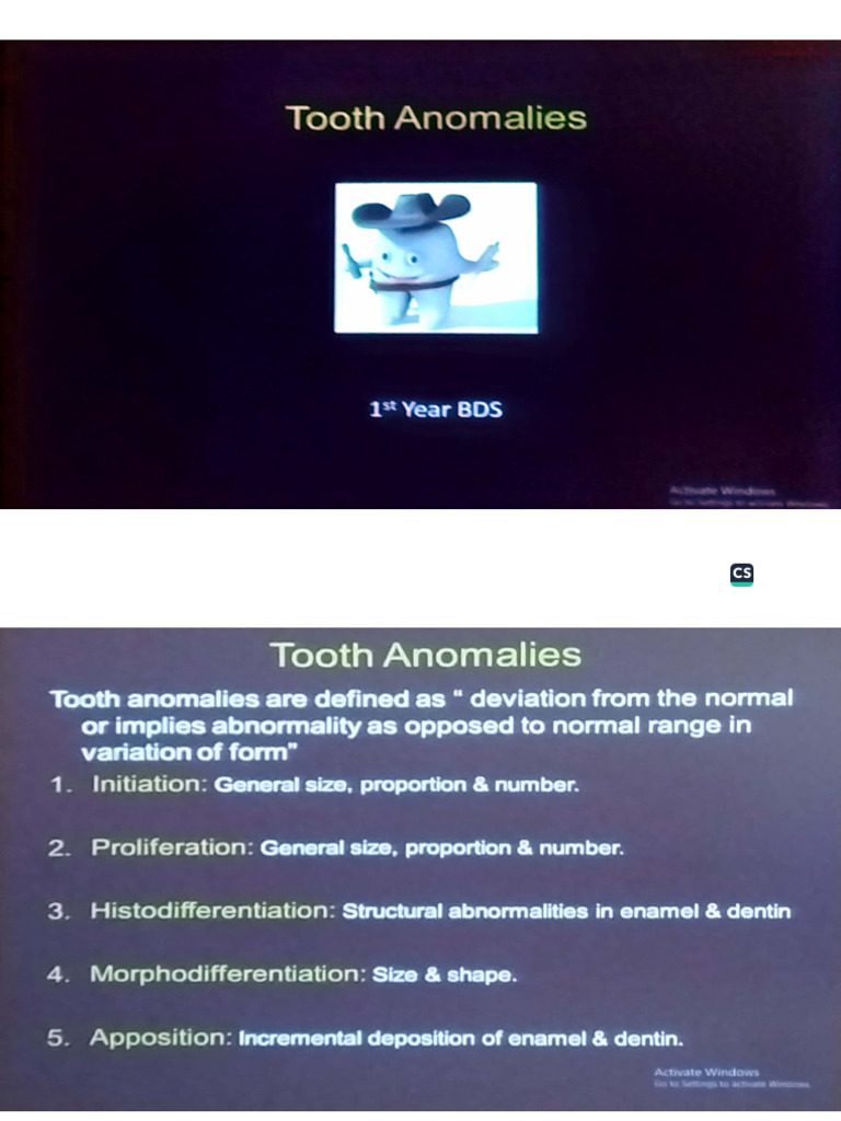 Abnormalities in Tooth | PDF