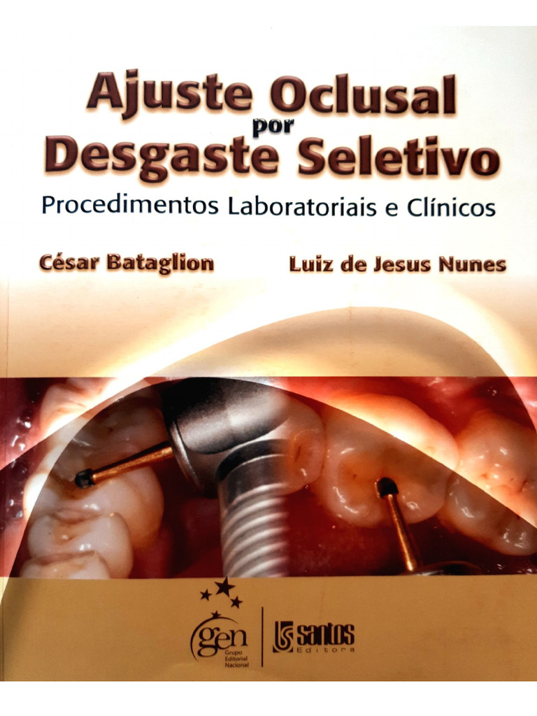 Ajuste Oclusal Por Desgaste Seletivo Procedimentos Laboratoriais | PDF