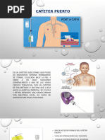 Triptico - Cuidados Al Paciente Con Catéter Puerto | PDF