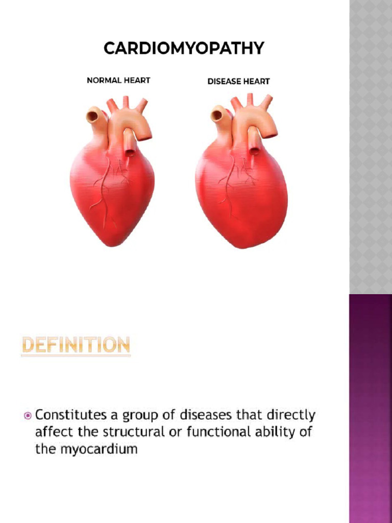Understanding Arrhythmogenic Cardiomyopathy | PDF