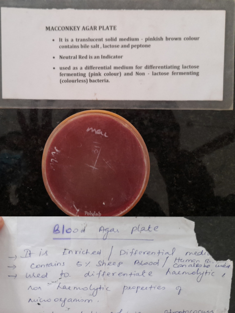 MICRO SPOTTERS 1 | PDF