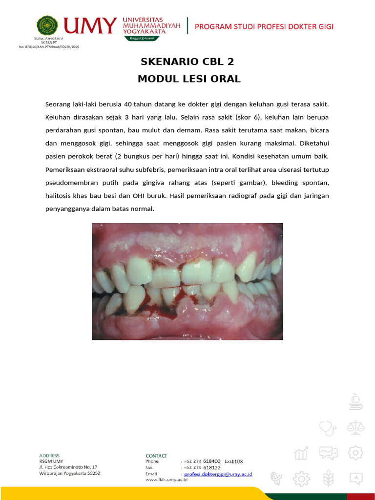 Kasus Lesi Oral pada Perokok Berat | PDF