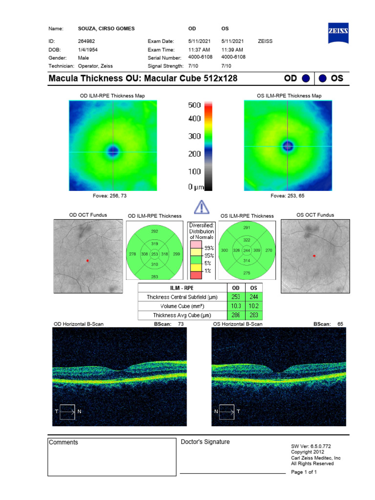 Macula Ao | PDF